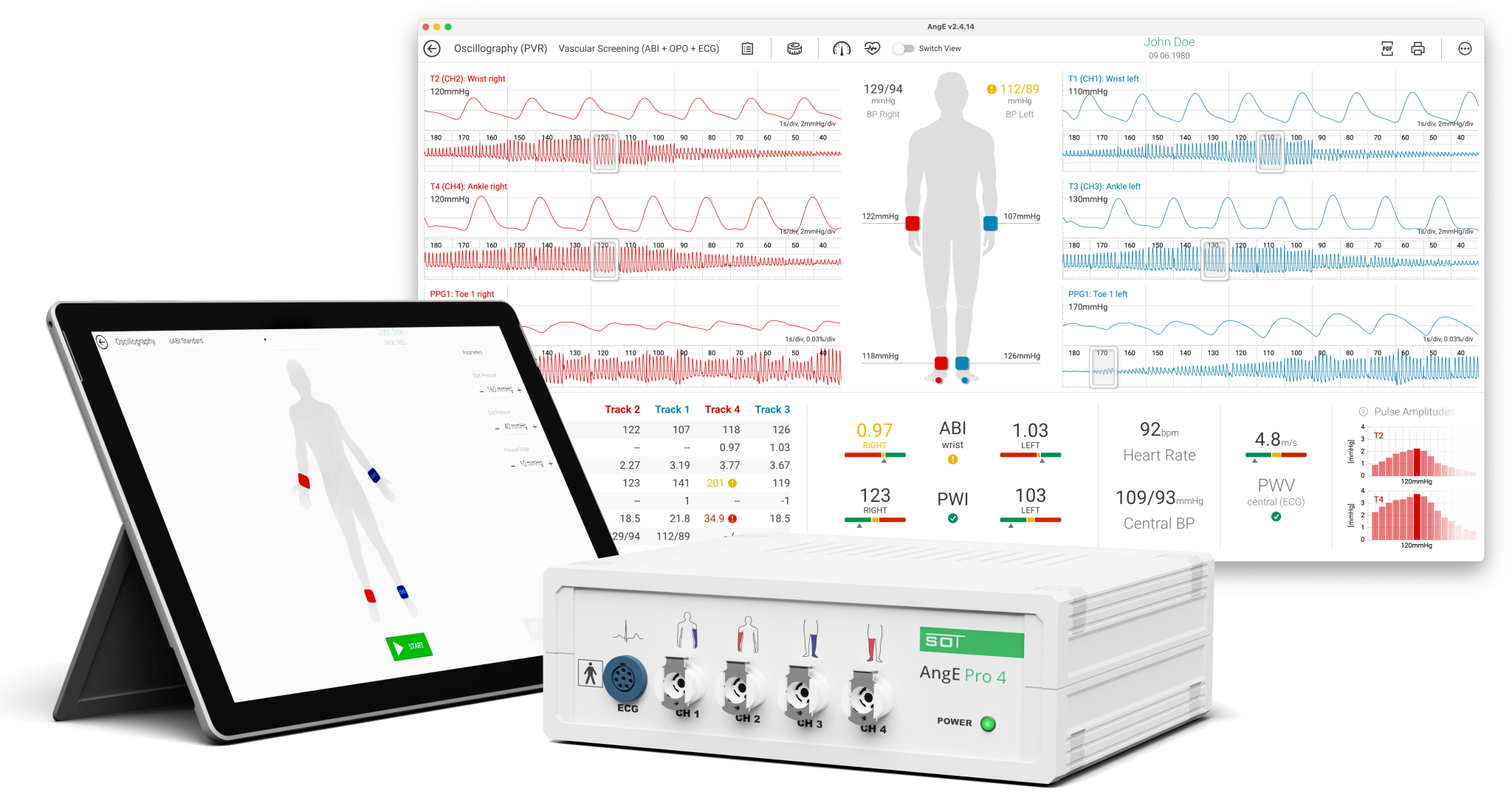 Early Detection Made Easy: The Value of Automated ABI Measurement - SOT ...