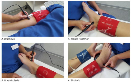 How to early detect PAD in 3 minutes - Guide - SOT Medical Systems