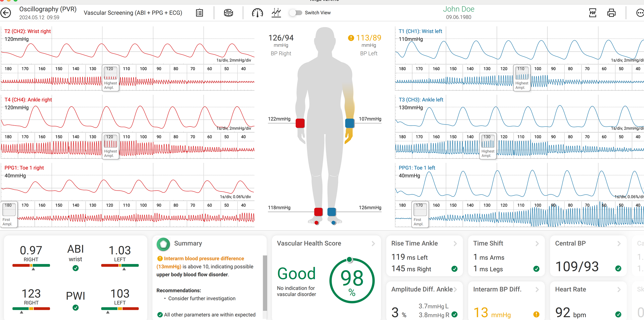 Know Your Parameter: ABI, TBI & PWI™ in Vascular Diagnostics - SOT ...