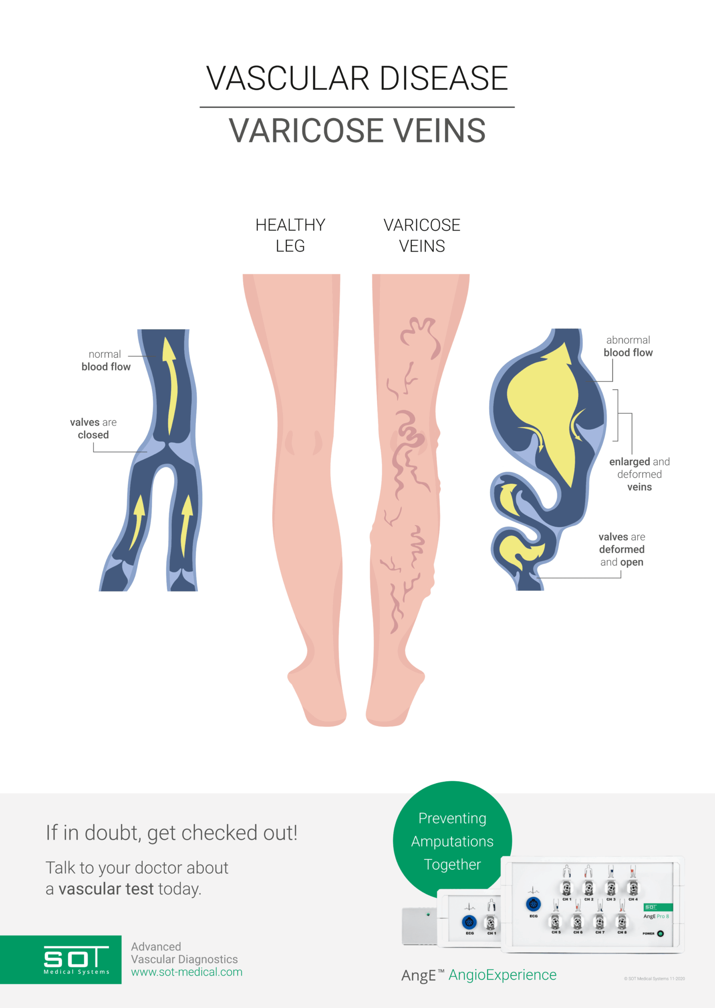 Infographic: Vascular Disease – Varicose Veins - SOT Medical Systems